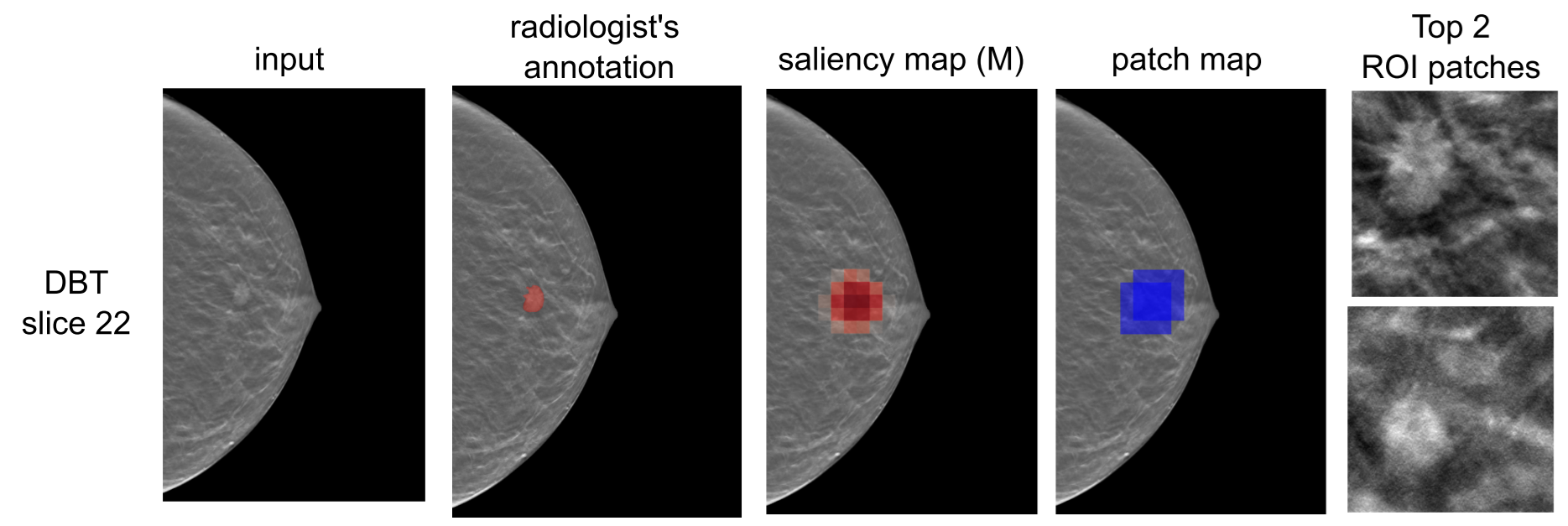 An Efficient Deep Neural Network to Classify Large 3D Images With Small Objects | JP